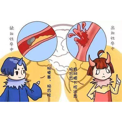 MCAO模型要点解析 - 瑞沃德资源中心